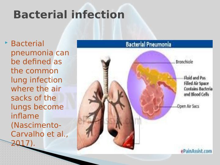 NSC2500: Pneumonia & Amoxicillin - Treatment and Action