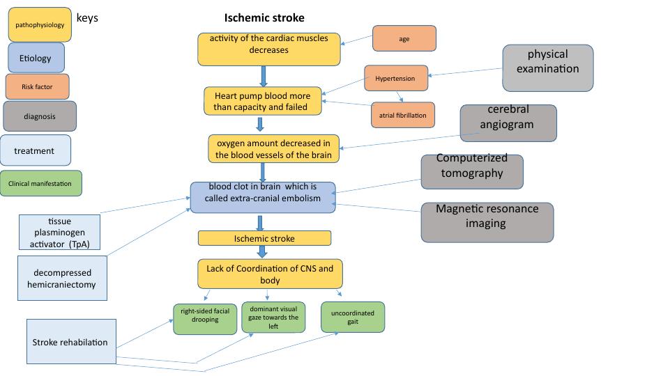 Analysis of Ischemic Stroke Case Study and Management